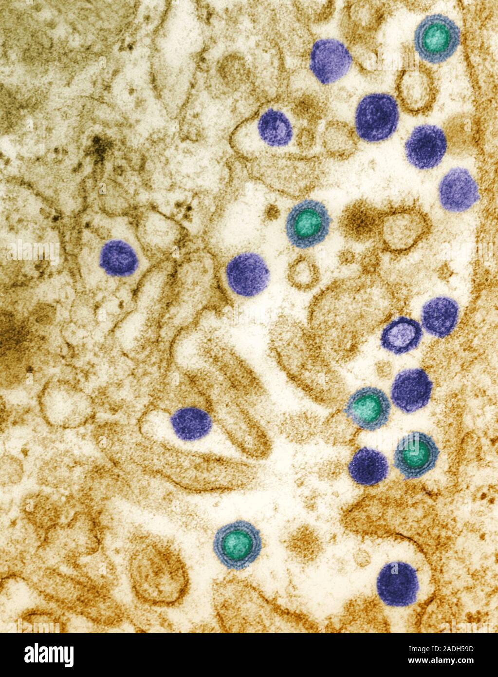 AIDS virus particles (blue and green) budding from the surface of a T4 ...