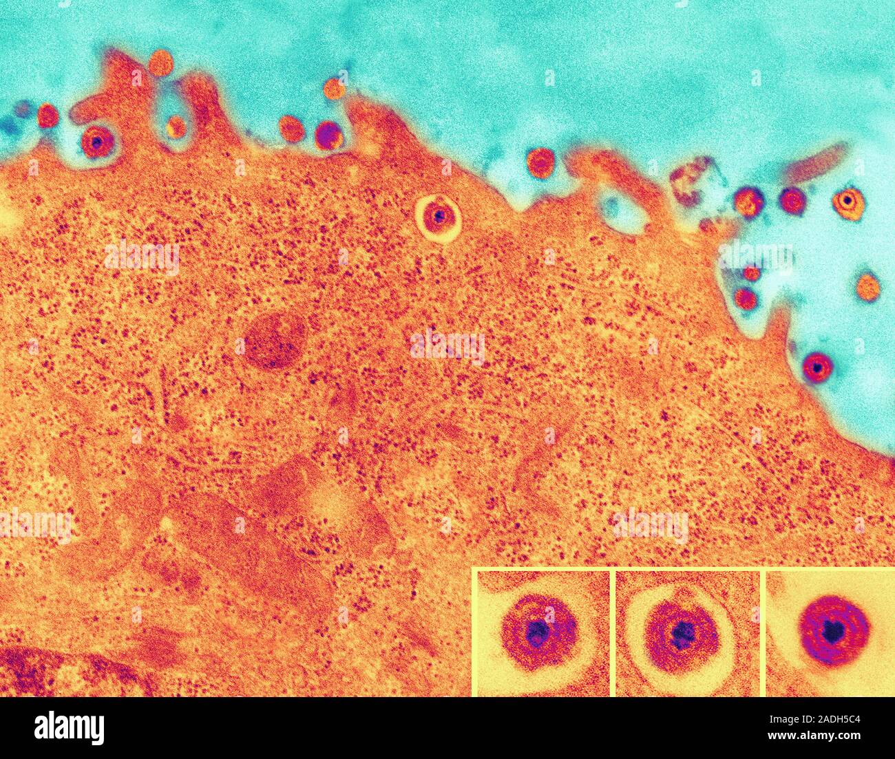 Herpes simplex viruses. Coloured transmission electron micrograph (TEM ... Herpes simplex viruses. Coloured transmission electron micrograph (TEM ...