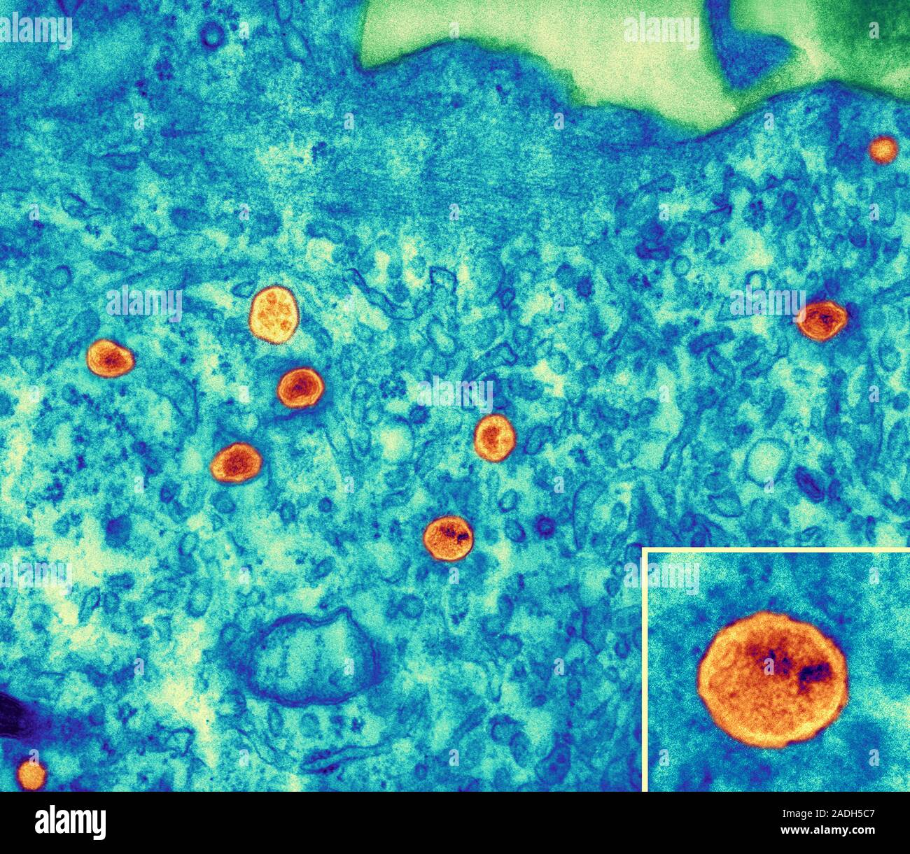 HIV particles. Coloured transmission electron micrograph (TEM) of human ...