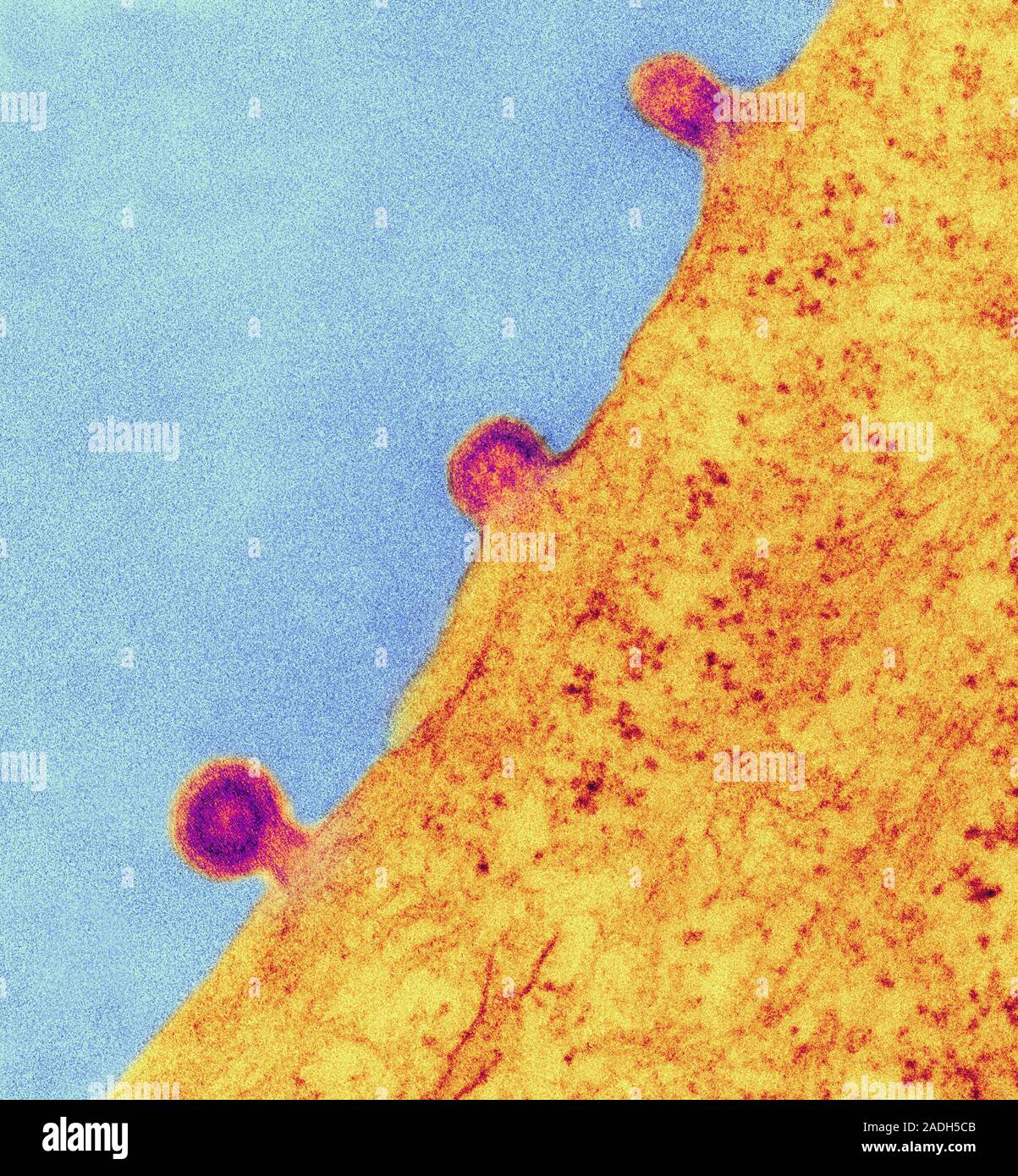Herpes simplex viruses. Coloured transmission electron micrograph (TEM ... Herpes simplex viruses. Coloured transmission electron micrograph (TEM ...