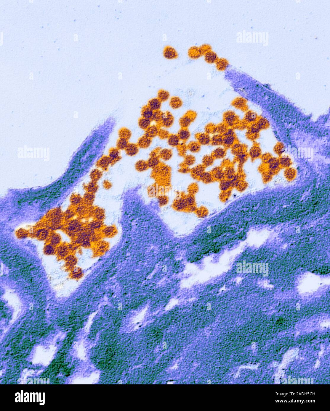 Human papillomavirus particles. Coloured transmission electron ...
