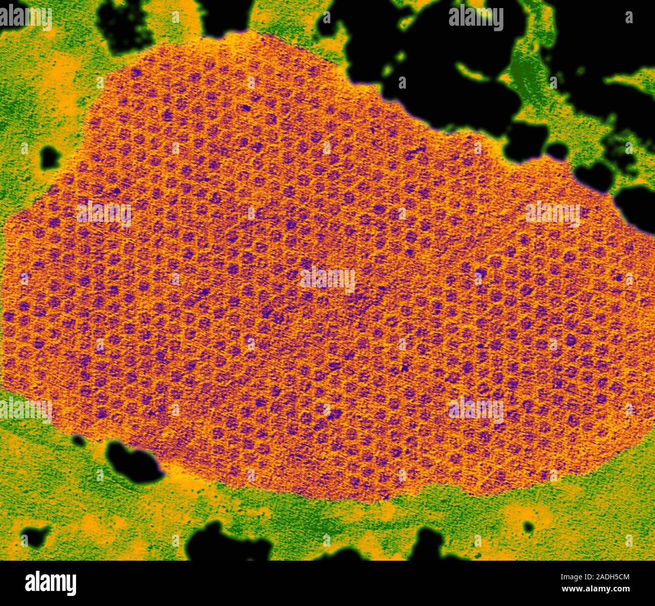 Human papillomavirus particles. Coloured transmission electron ...