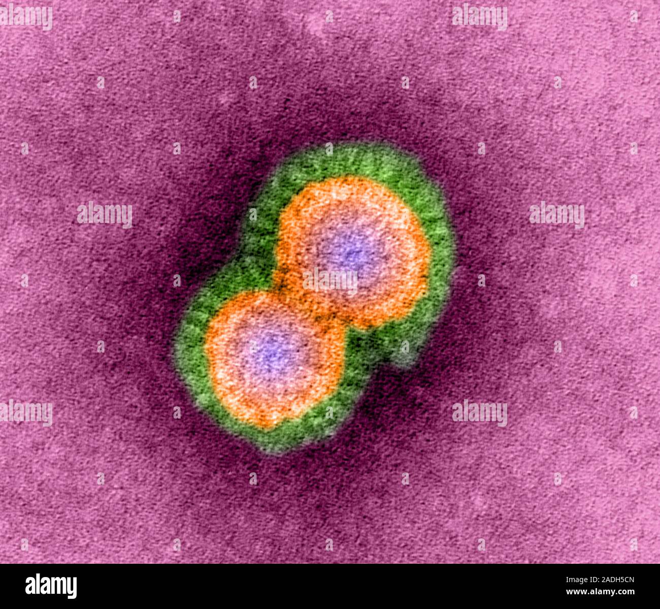 H5N1 avian influenza virus particles, coloured transmission electron ...