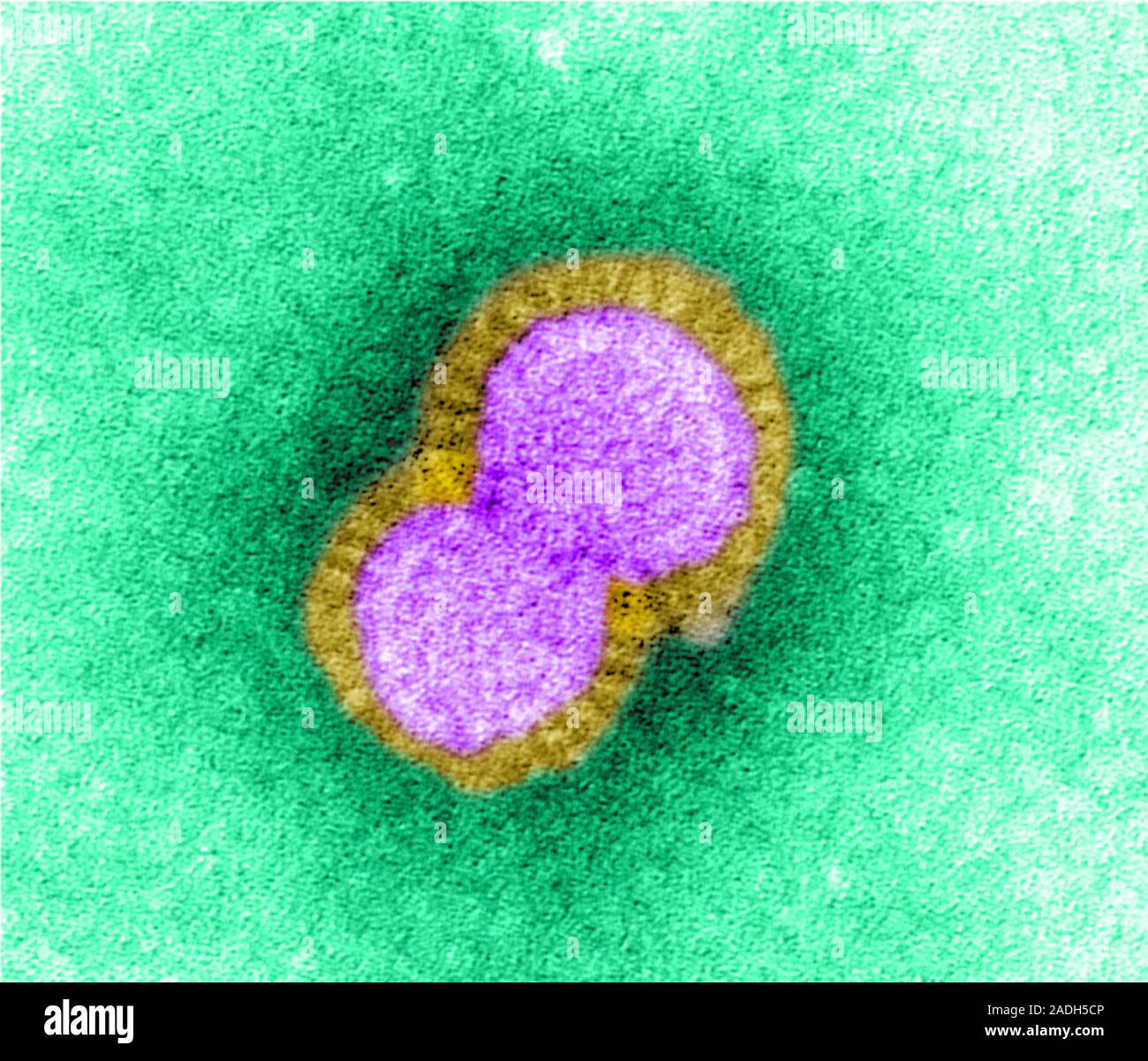 H5N1 avian influenza virus particles, coloured transmission electron ...