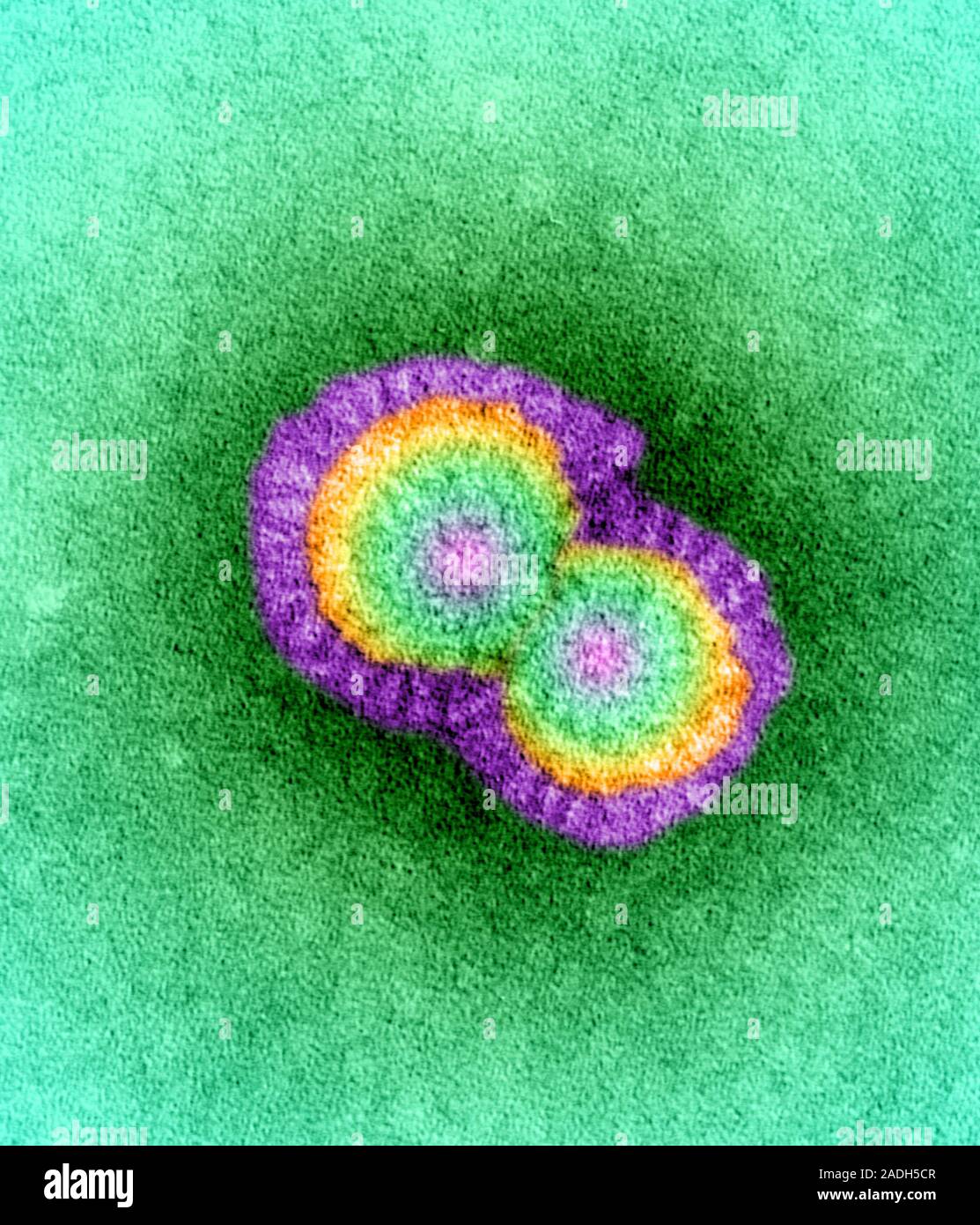 H5N1 avian influenza virus particles, coloured transmission electron ...