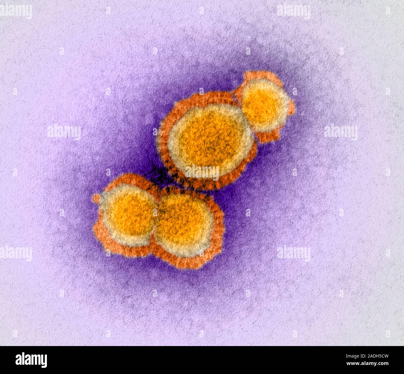 H5N1 avian influenza virus particles, coloured transmission electron ...