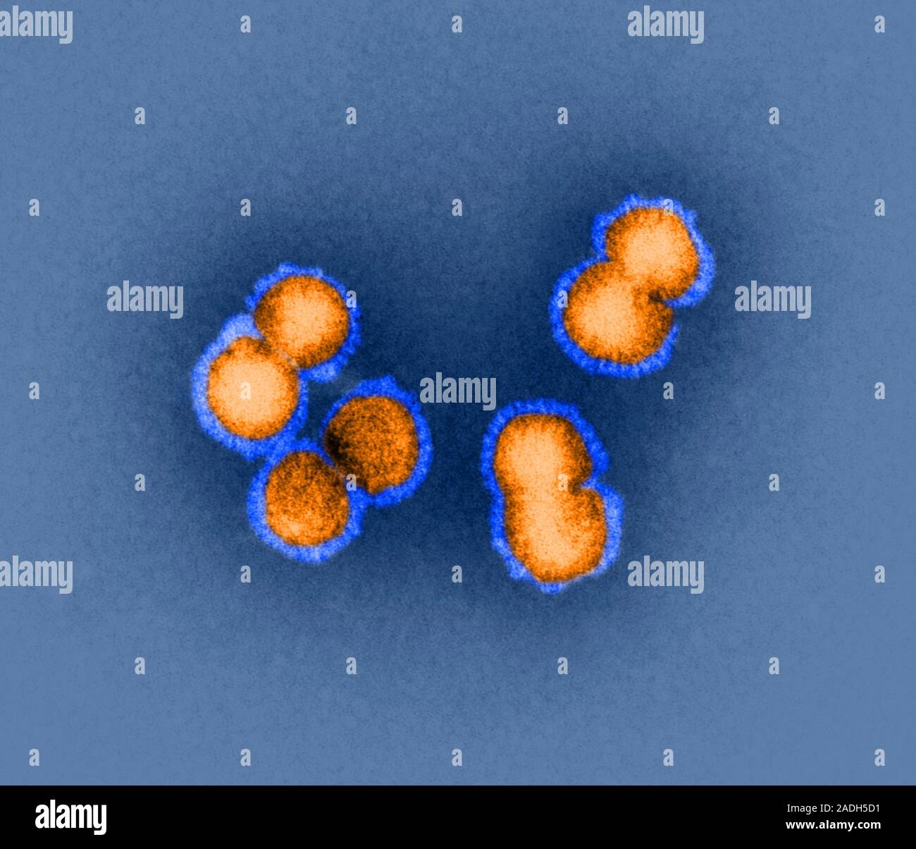 H5N1 avian influenza virus particles, coloured transmission electron ...
