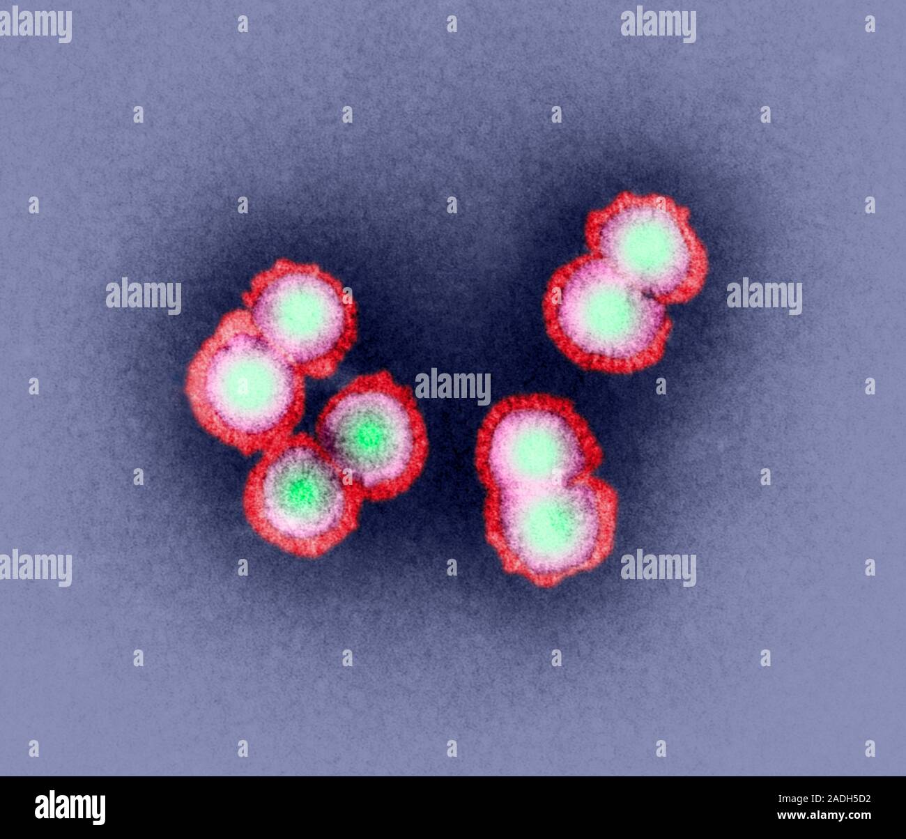 H5N1 avian influenza virus particles, coloured transmission electron ...