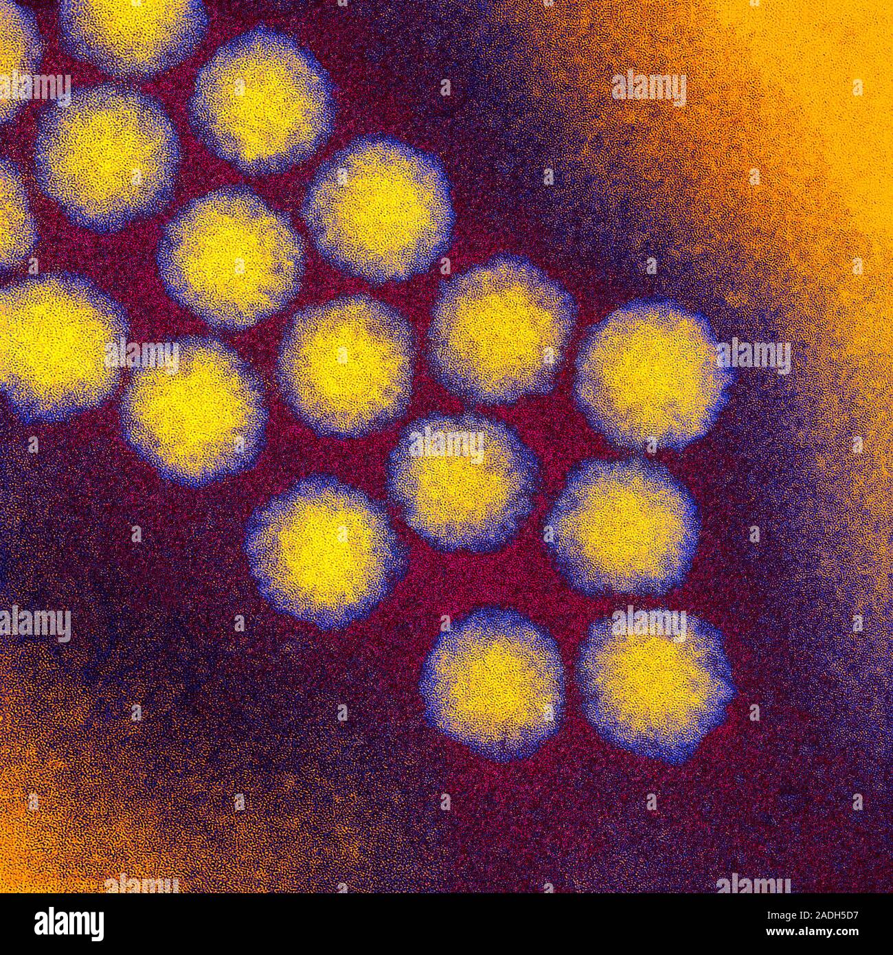 Poliovirus particles. Coloured transmission electron micrograph (TEM ...