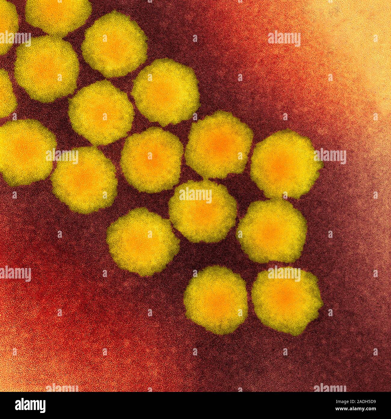 Poliovirus particles. Coloured transmission electron micrograph (TEM ...