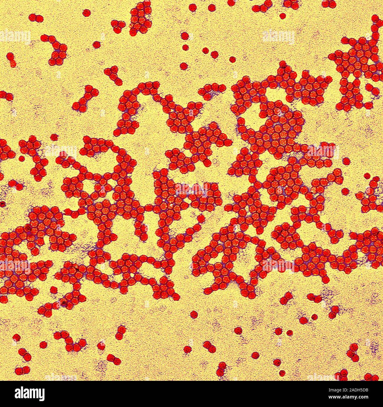 Poliovirus particles. Coloured transmission electron micrograph (TEM ...