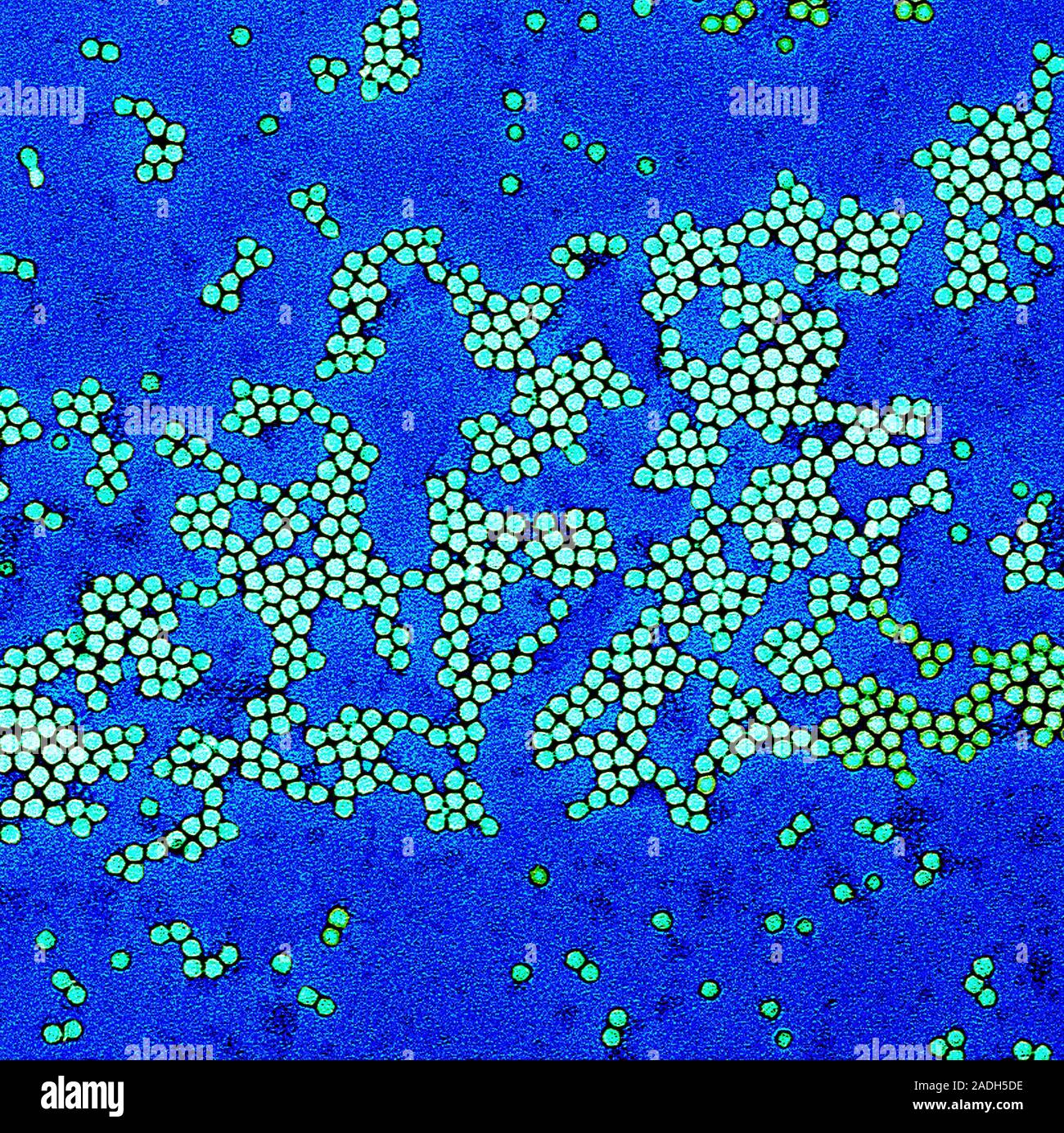 Poliovirus particles. Coloured transmission electron micrograph (TEM ...