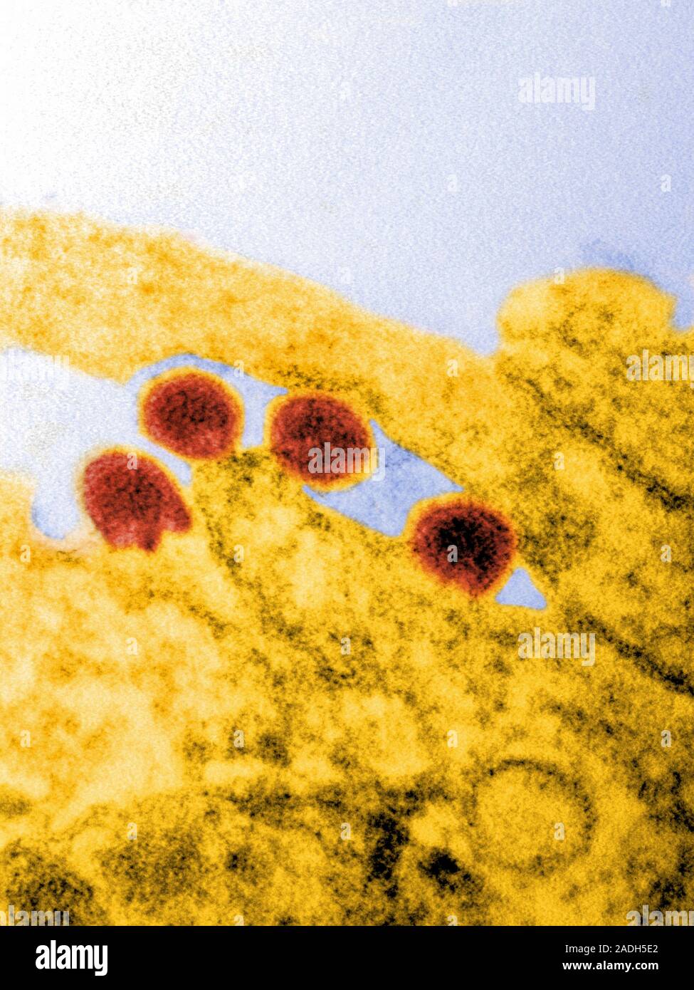 Chikungunya virus. Coloured transmission electron micrograph (TEM) of ...