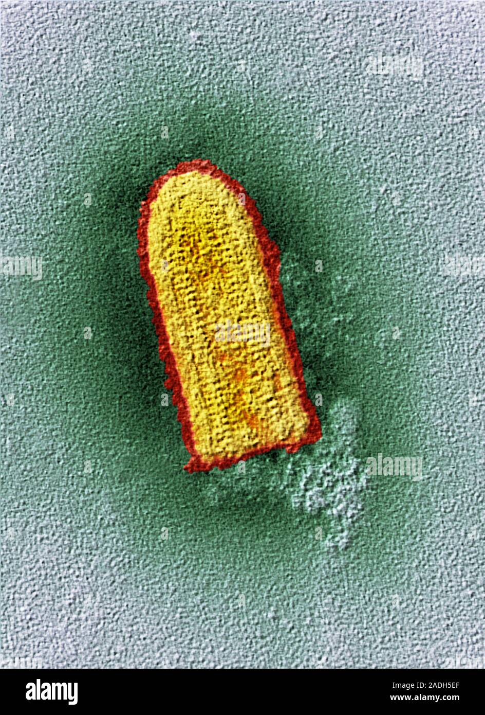 Rabies virus. Coloured transmission electron micrograph (TEM) of the ...
