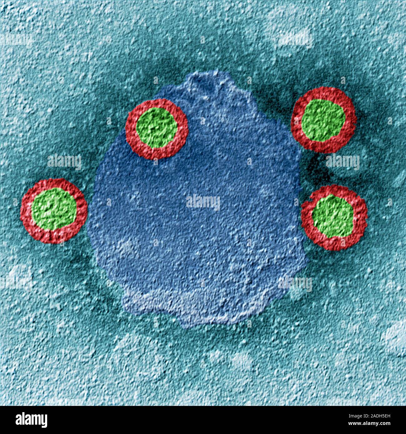 Rotavirus particles. Coloured transmission electron micrograph (TEM) of ...