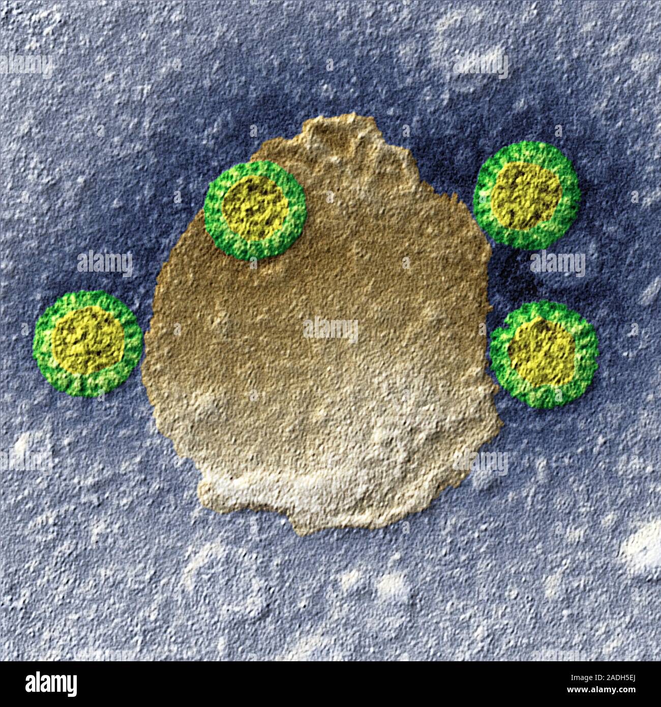 Rotavirus particles. Coloured transmission electron micrograph (TEM) of ...