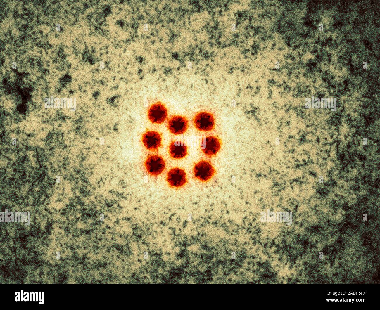 Astrovirus particles. Coloured transmission electron micrograph (TEM ...
