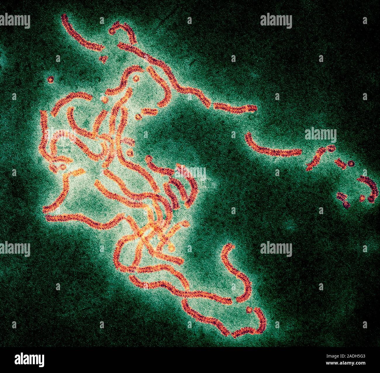Mumps virus. Coloured transmission electron micrograph (TEM) of mumps ...