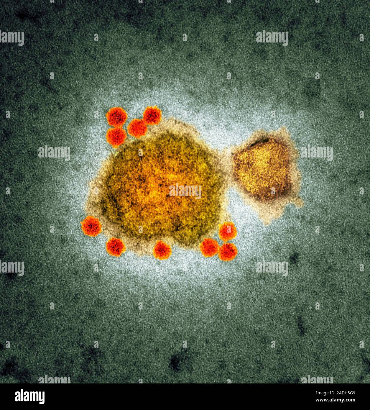 Parvovirus particles. Coloured transmission electron micrograph (TEM ...