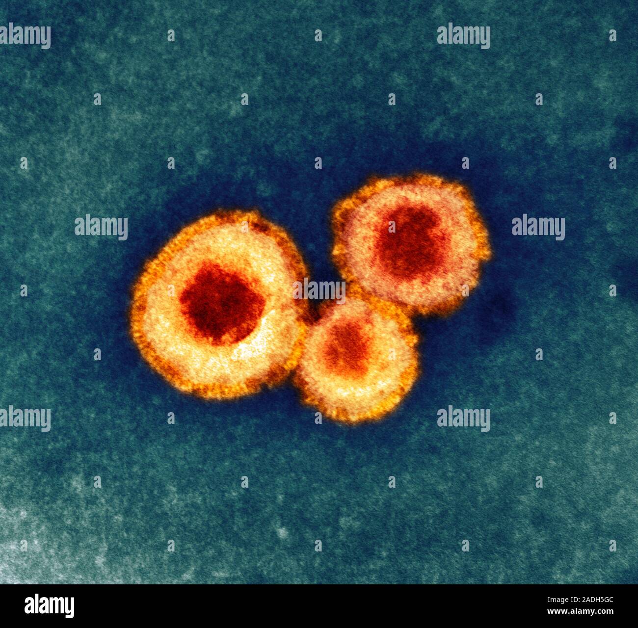 Human metapneumovirus particles. Coloured transmission electron ...