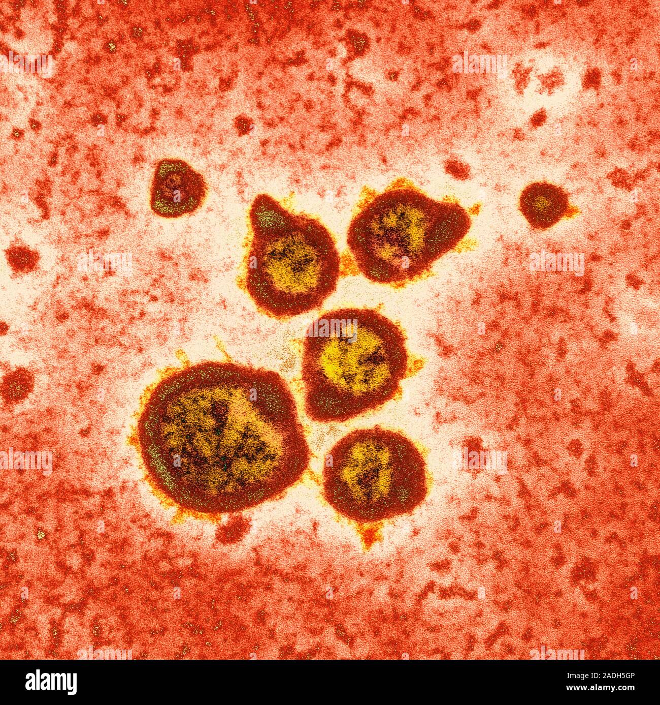 Respiratory syncytial virus (RSV) particles, coloured transmission ...