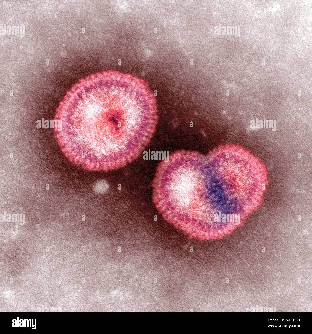 Influenzavirus B. Coloured transmission electron micrograph (TEM) of ...