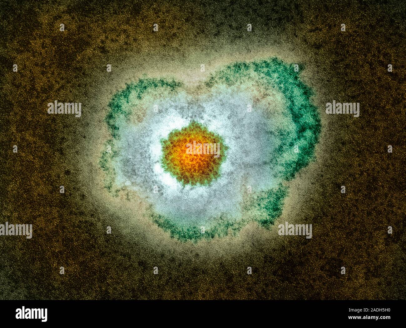 Herpes simplex virus particle, coloured transmission electron ...