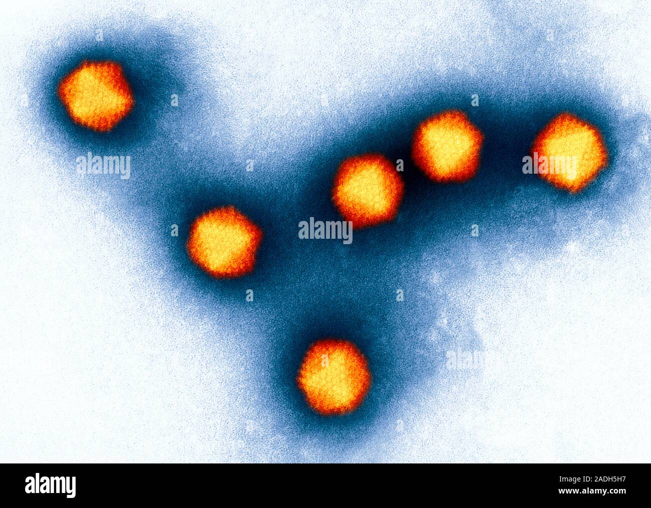 Adenovirus particles. Coloured transmission electron micrograph (TEM ...