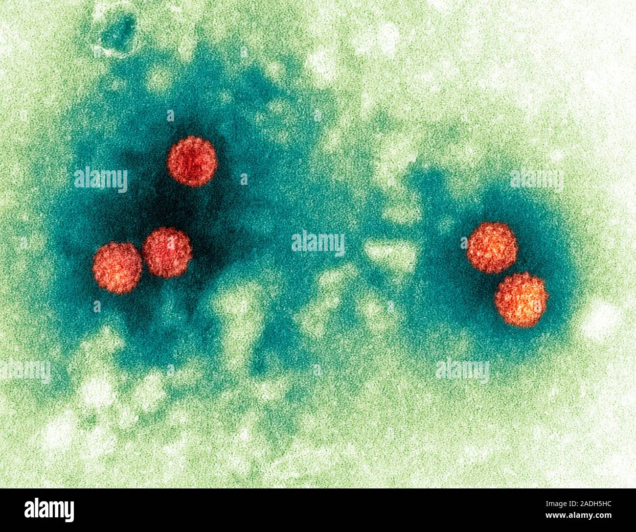 Polyoma virus particles. Coloured transmission electron micrograph (TEM ...