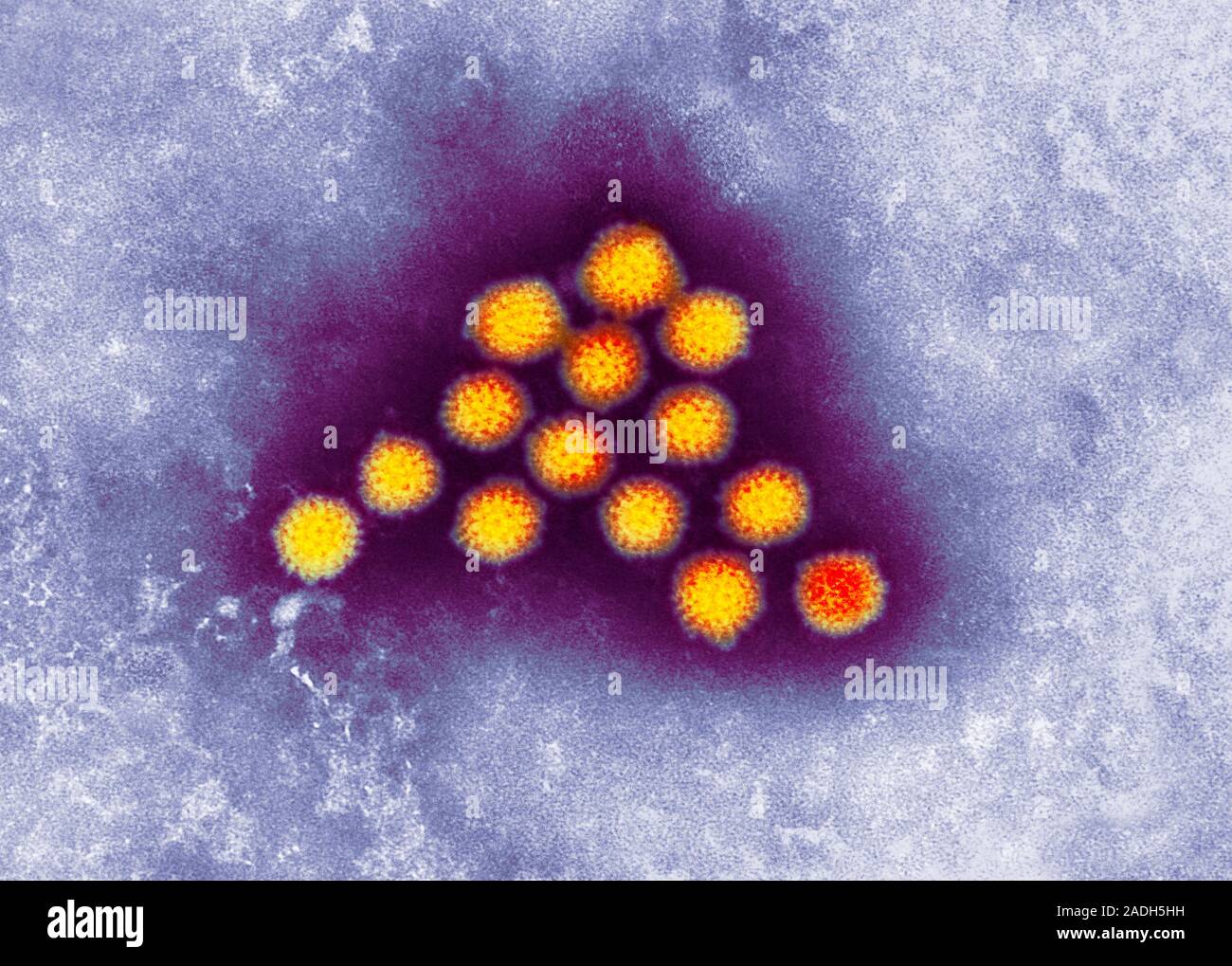 Rotavirus particles. Coloured transmission electron micrograph (TEM) of ...