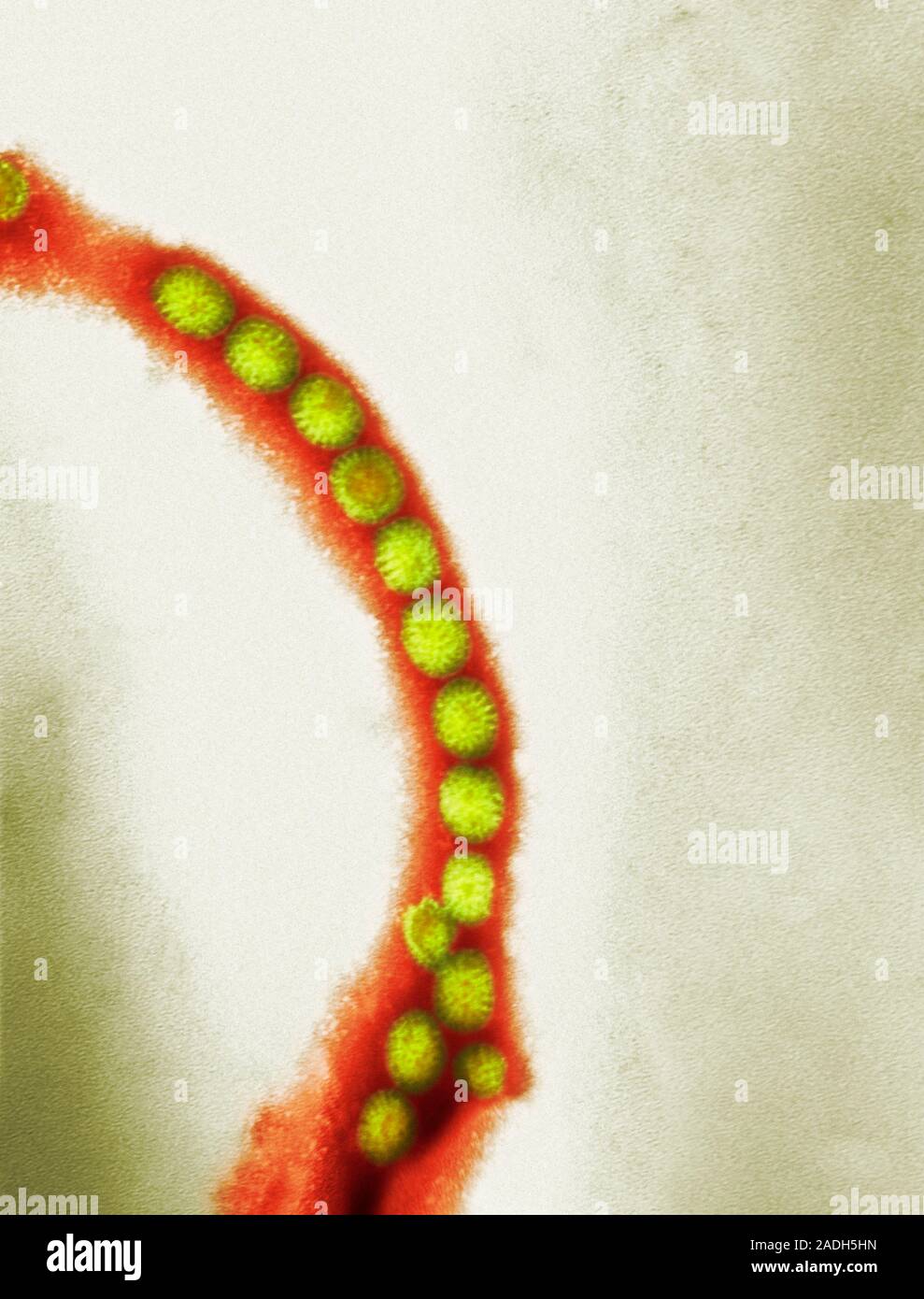 Rotavirus particles. Coloured transmission electron micrograph (TEM) of ...