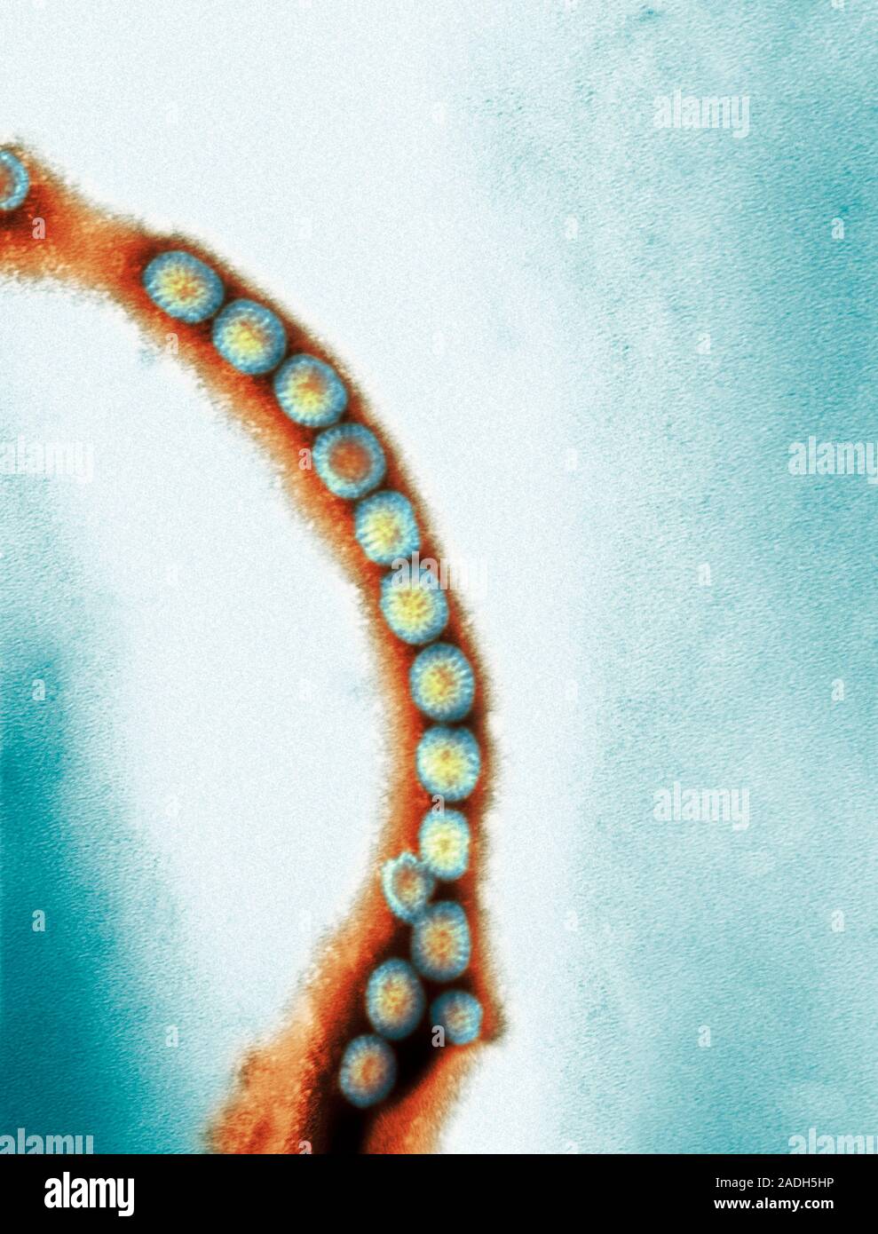 Rotavirus particles. Coloured transmission electron micrograph (TEM) of ...