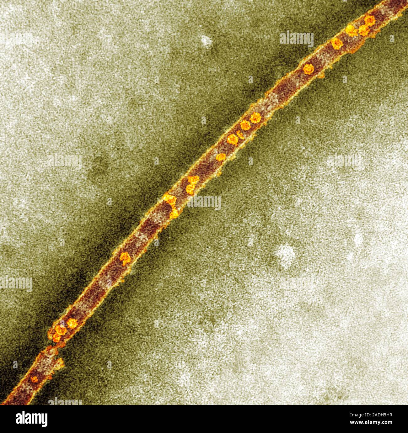 Human bocavirus particles, lined up within a baculovirus, coloured ...