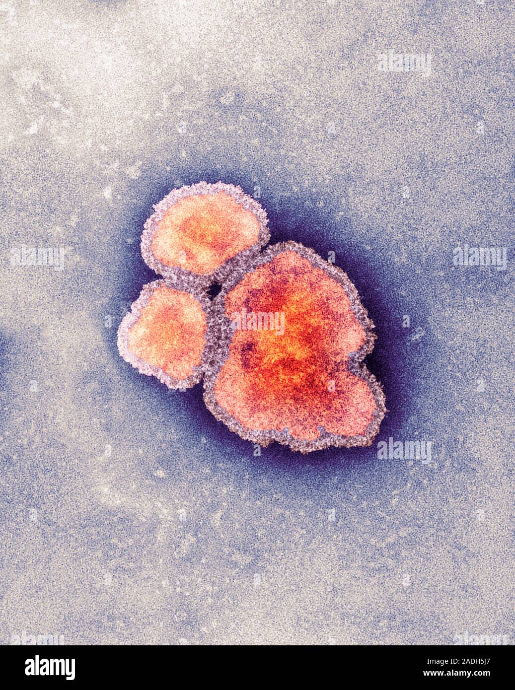 Measles virus particles. Coloured transmission electron micrograph (TEM ...