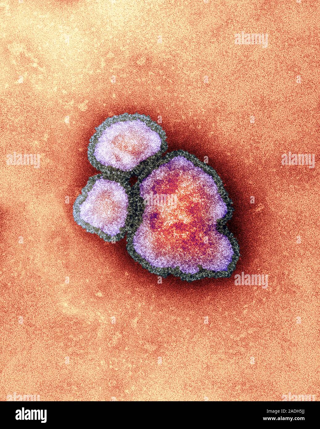 Measles virus particles. Coloured transmission electron micrograph (TEM ... Measles virus particles. Coloured transmission electron micrograph (TEM ...
