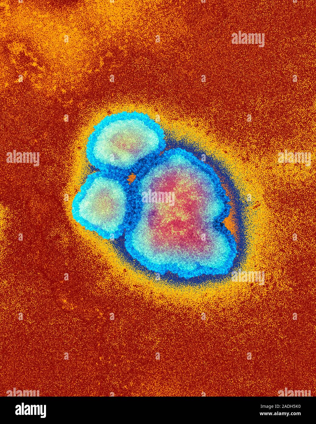 Measles virus particles. Coloured transmission electron micrograph (TEM ...