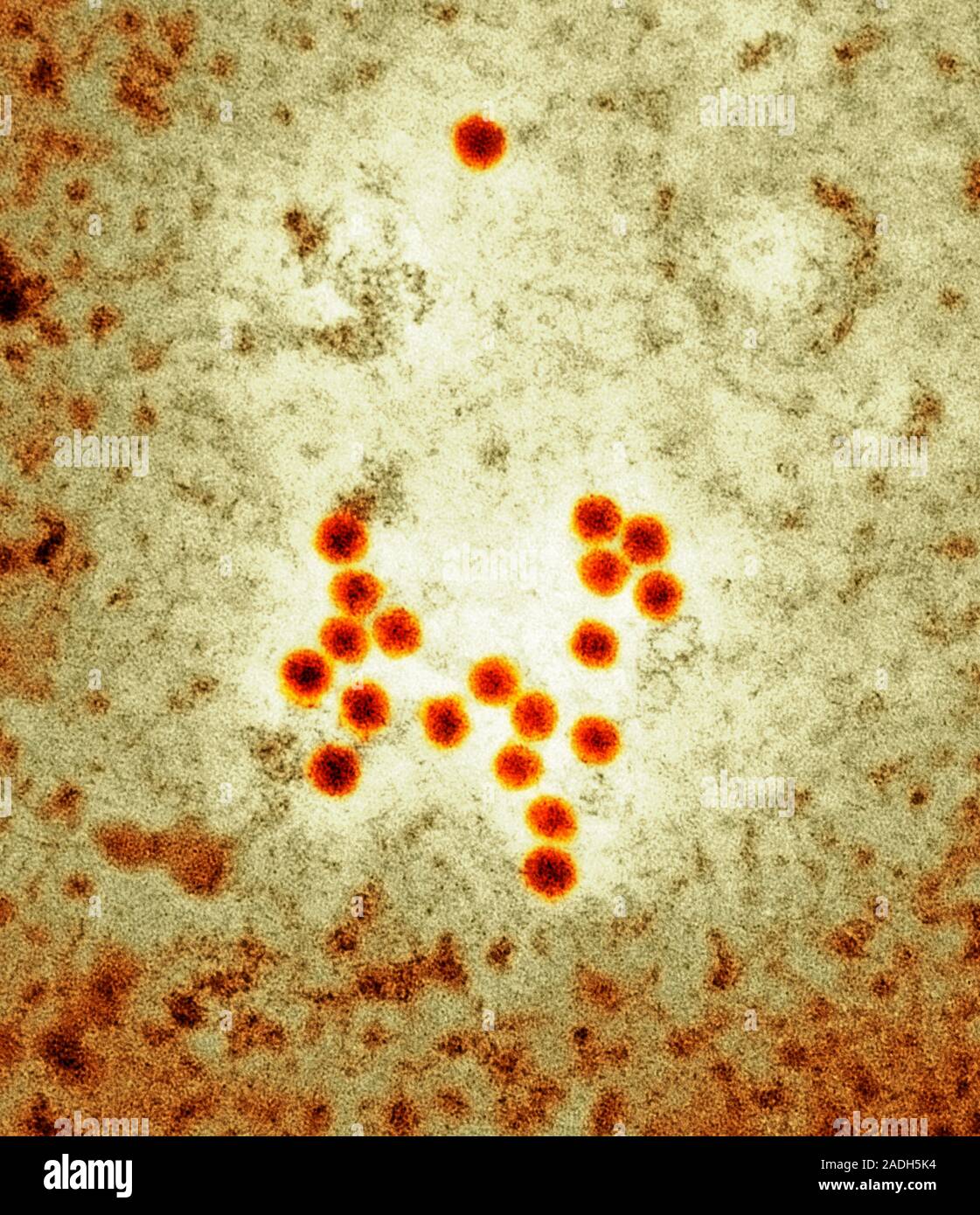 Coxsackie virus particles, coloured transmission electron micrograph (TEM). Coxsackie viruses ...