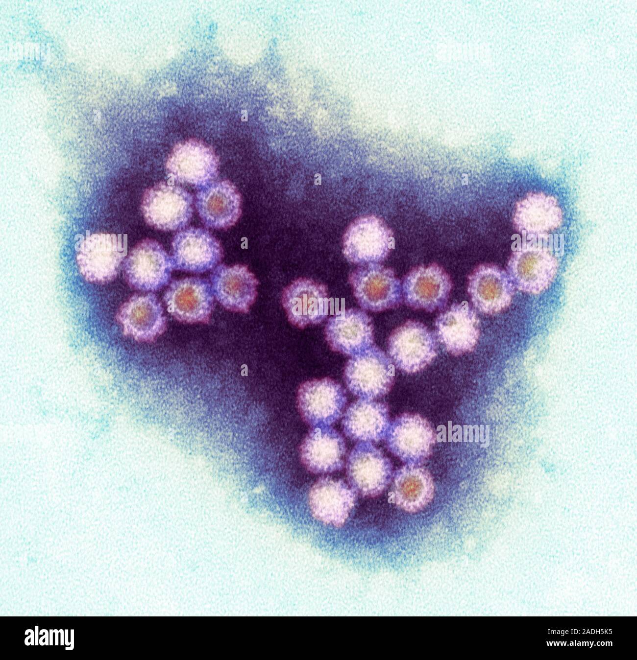 Norovirus particles. Coloured transmission electron micrograph (TEM) of ...
