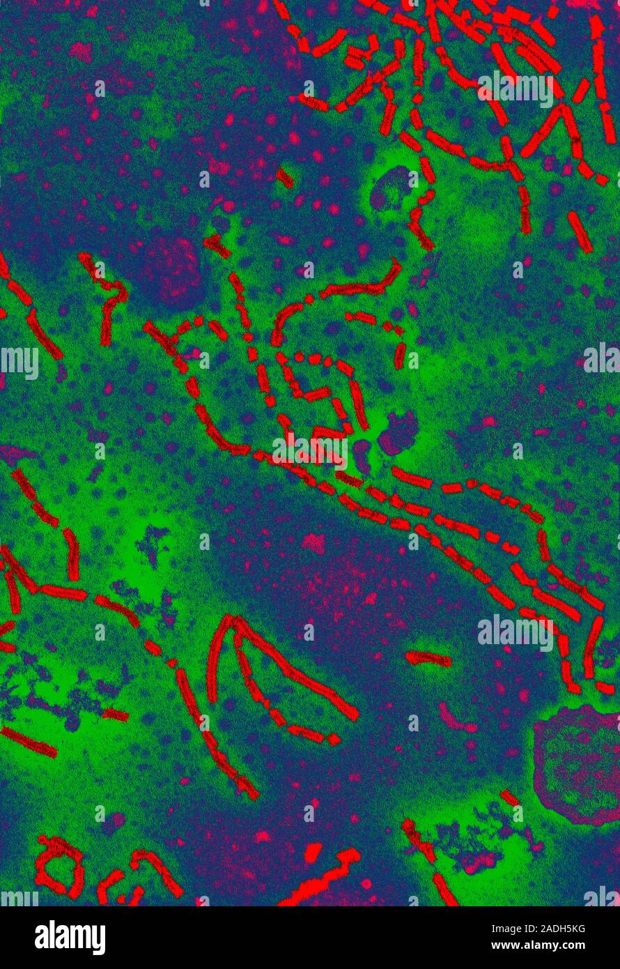 Paramyxovirus. Transmission electron micrograph (TEM) of paramyxovirus ...