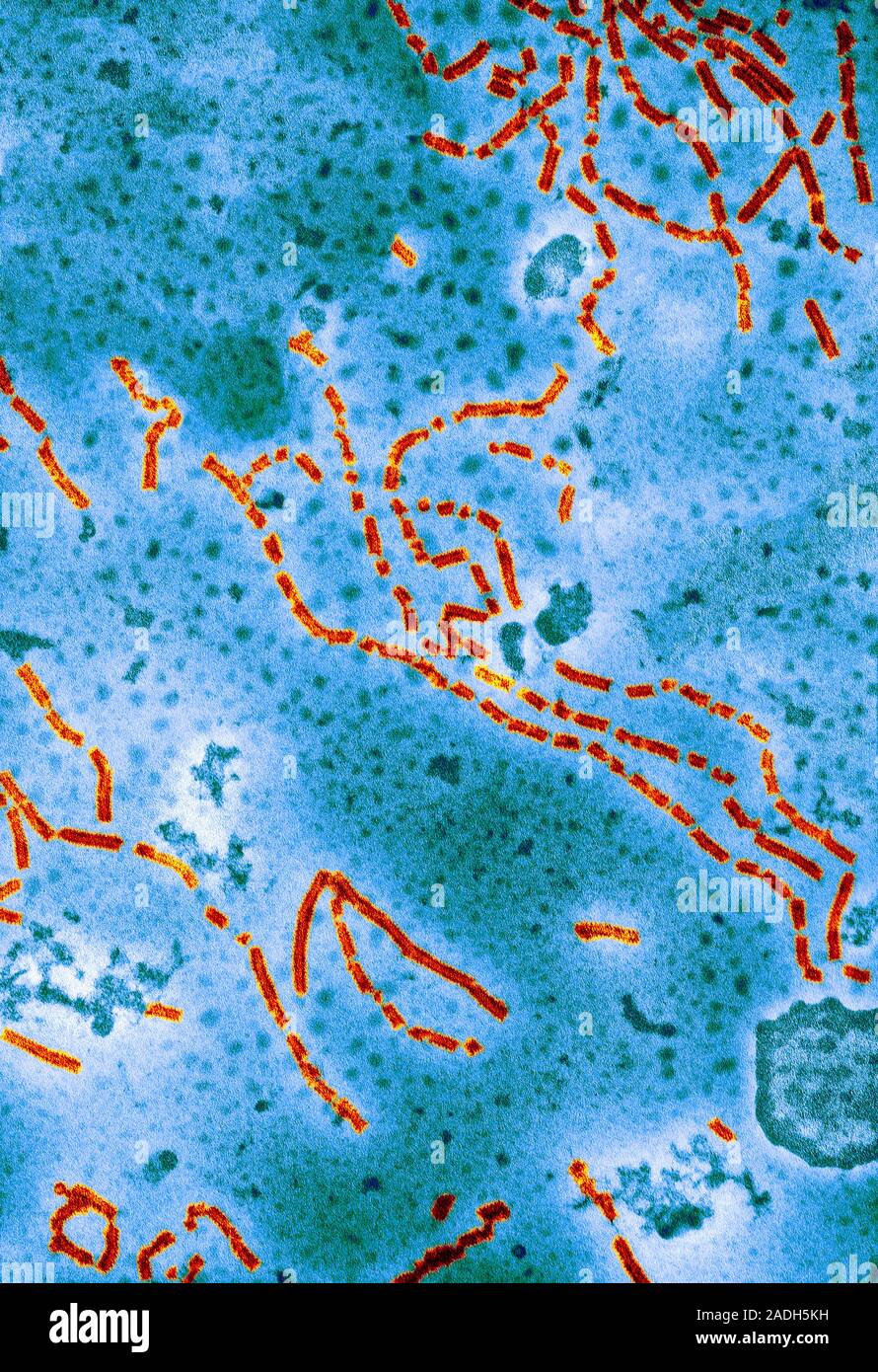 Paramyxovirus. Transmission electron micrograph (TEM) of paramyxovirus ...