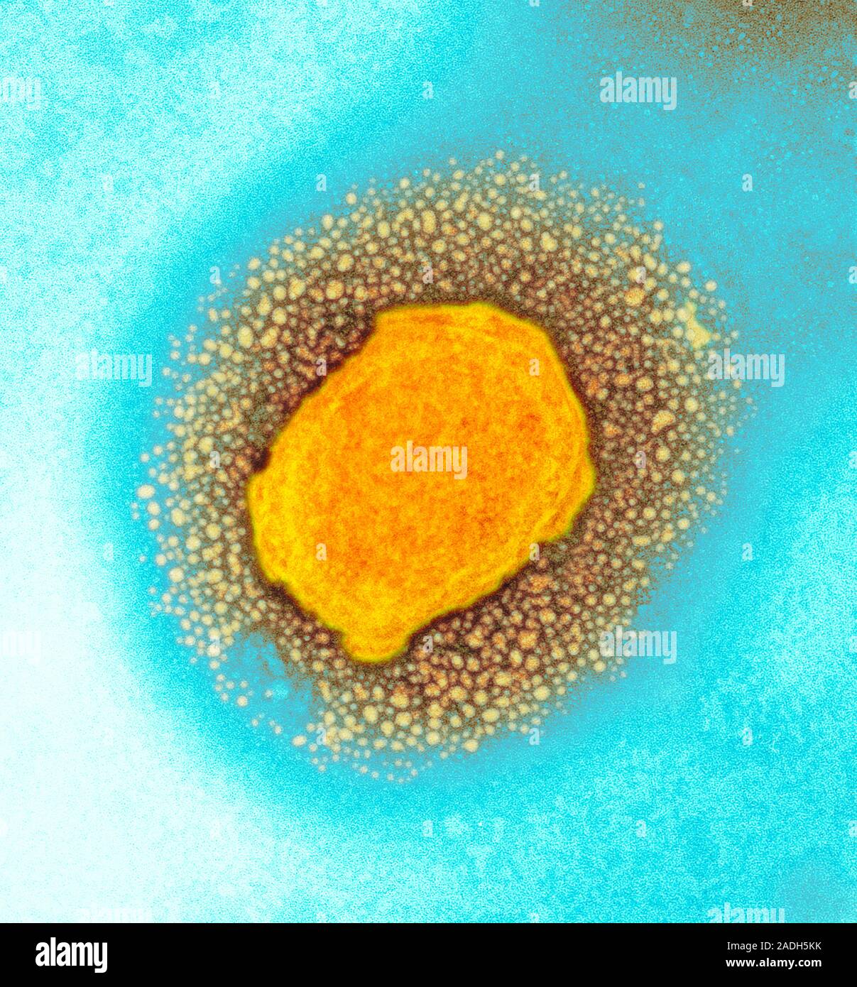 Monkeypox virus particle, coloured transmission electron micrograph ...