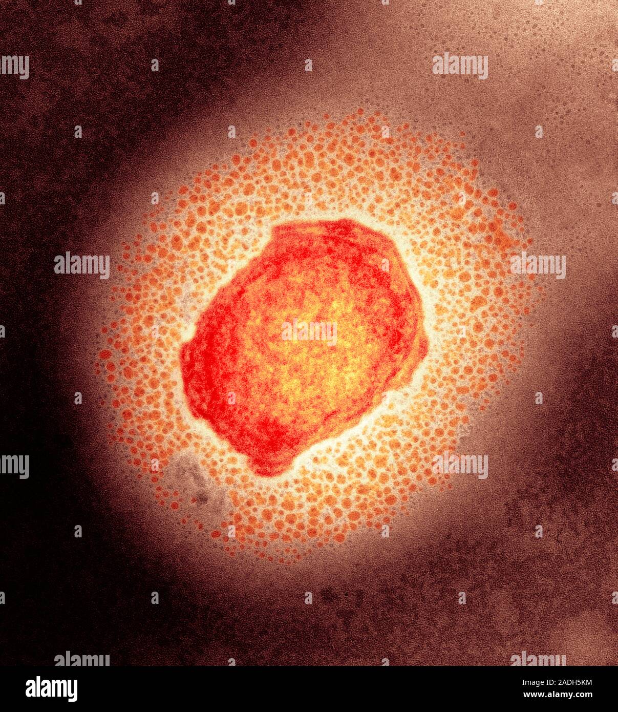 Monkeypox virus particle, coloured transmission electron micrograph ...