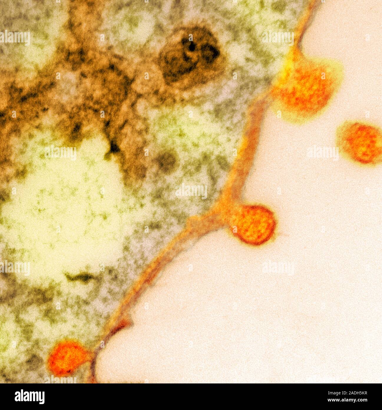 Budding human metapneumovirus particles. Coloured transmission electron ...