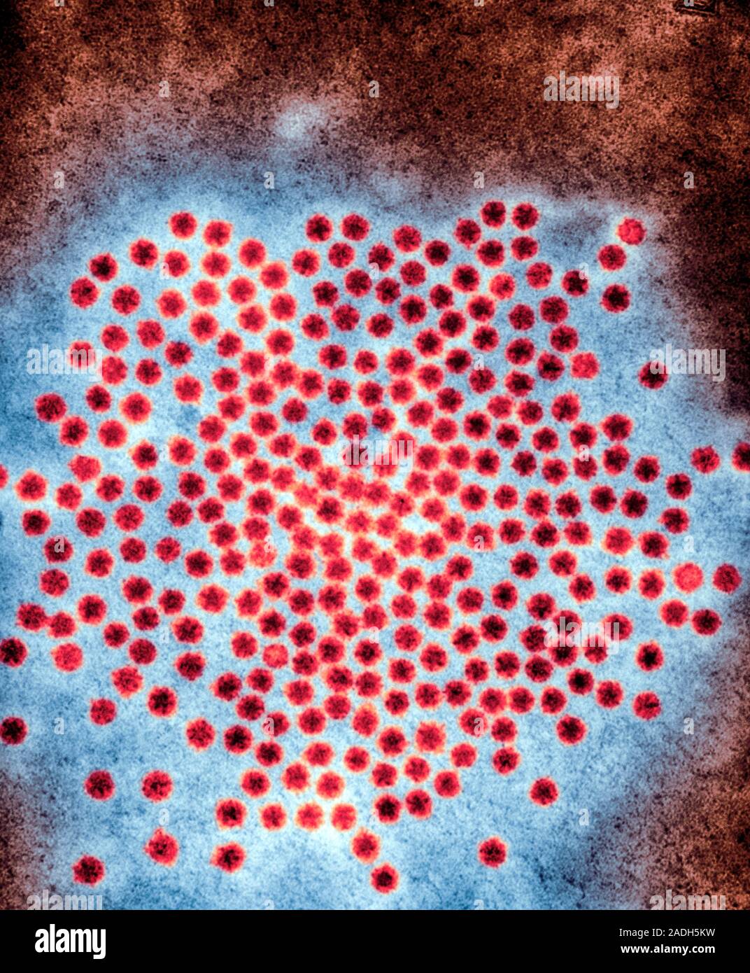 Astrovirus particles. Coloured transmission electron micrograph (TEM) of a cluster of astrovirus ...