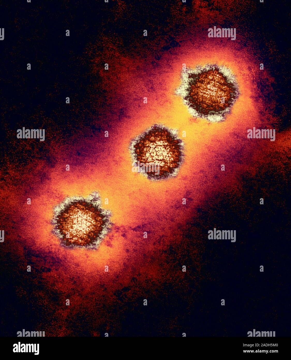 Herpes simplex virus particles, coloured transmission electron ...