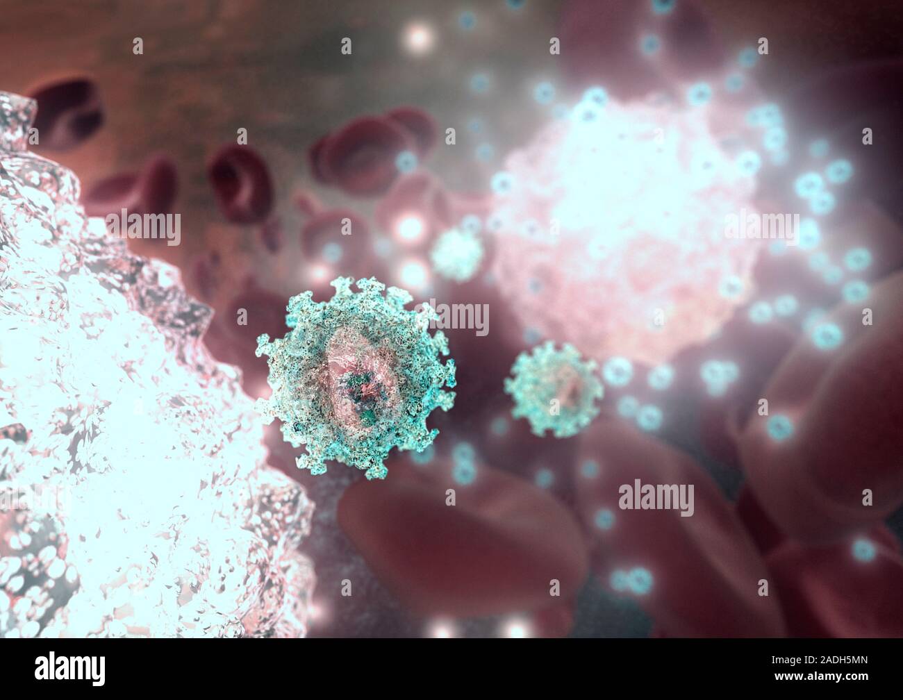 Budding HIV particle. Computer artwork of an HIV (human ...