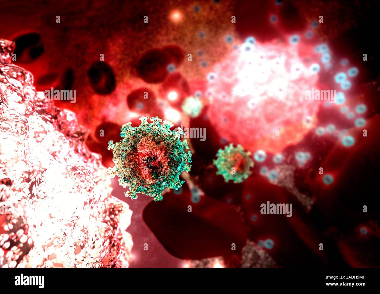 Budding HIV particle. Computer artwork of an HIV (human ...