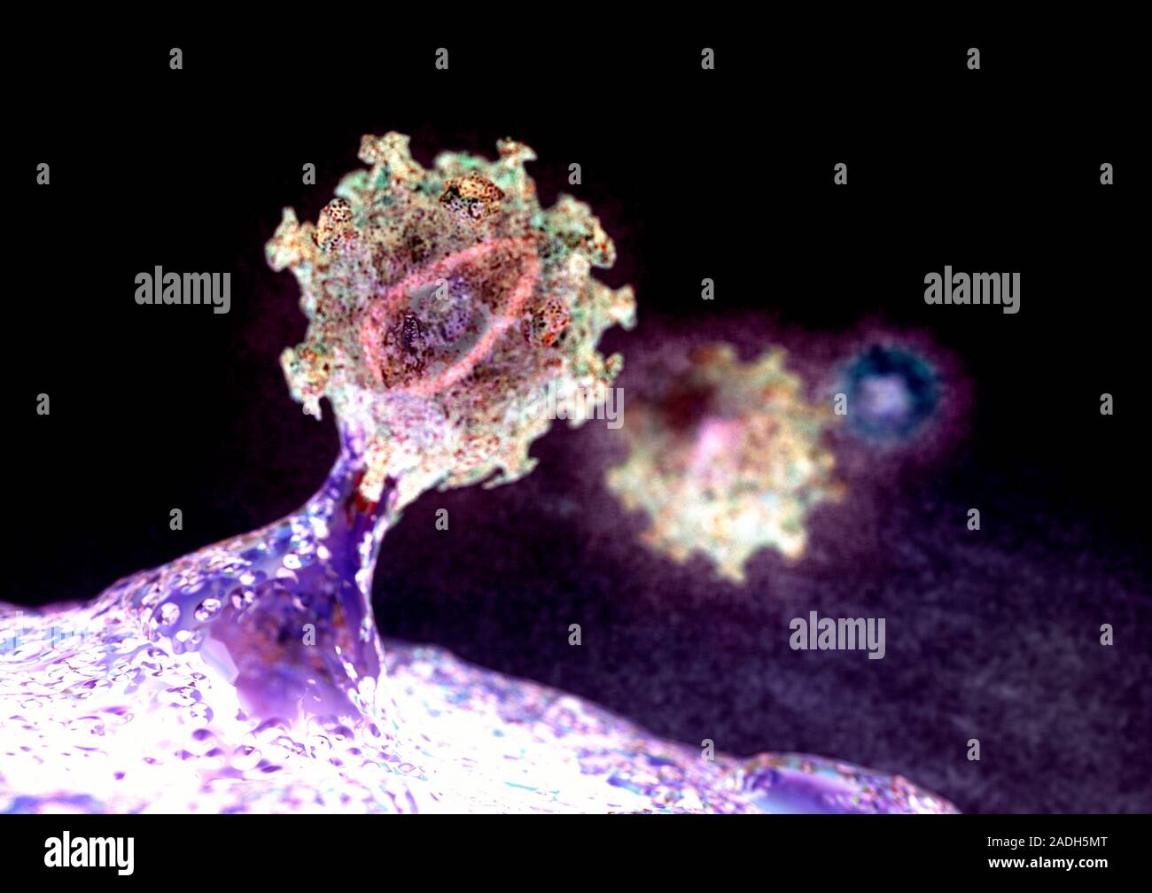 Budding HIV particle. Computer artwork of an HIV (human ...