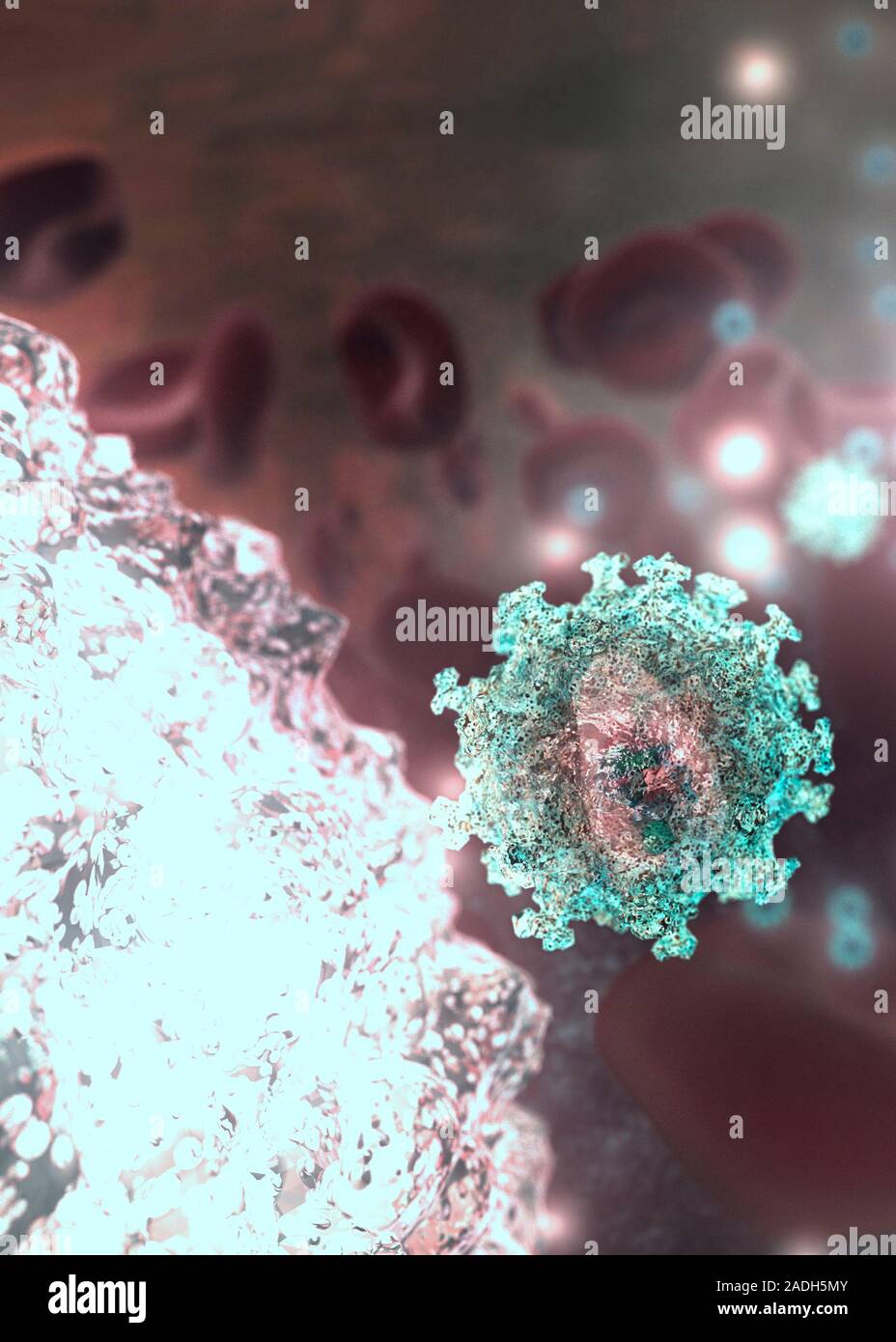 Budding HIV particle. Computer artwork of an HIV (human ...