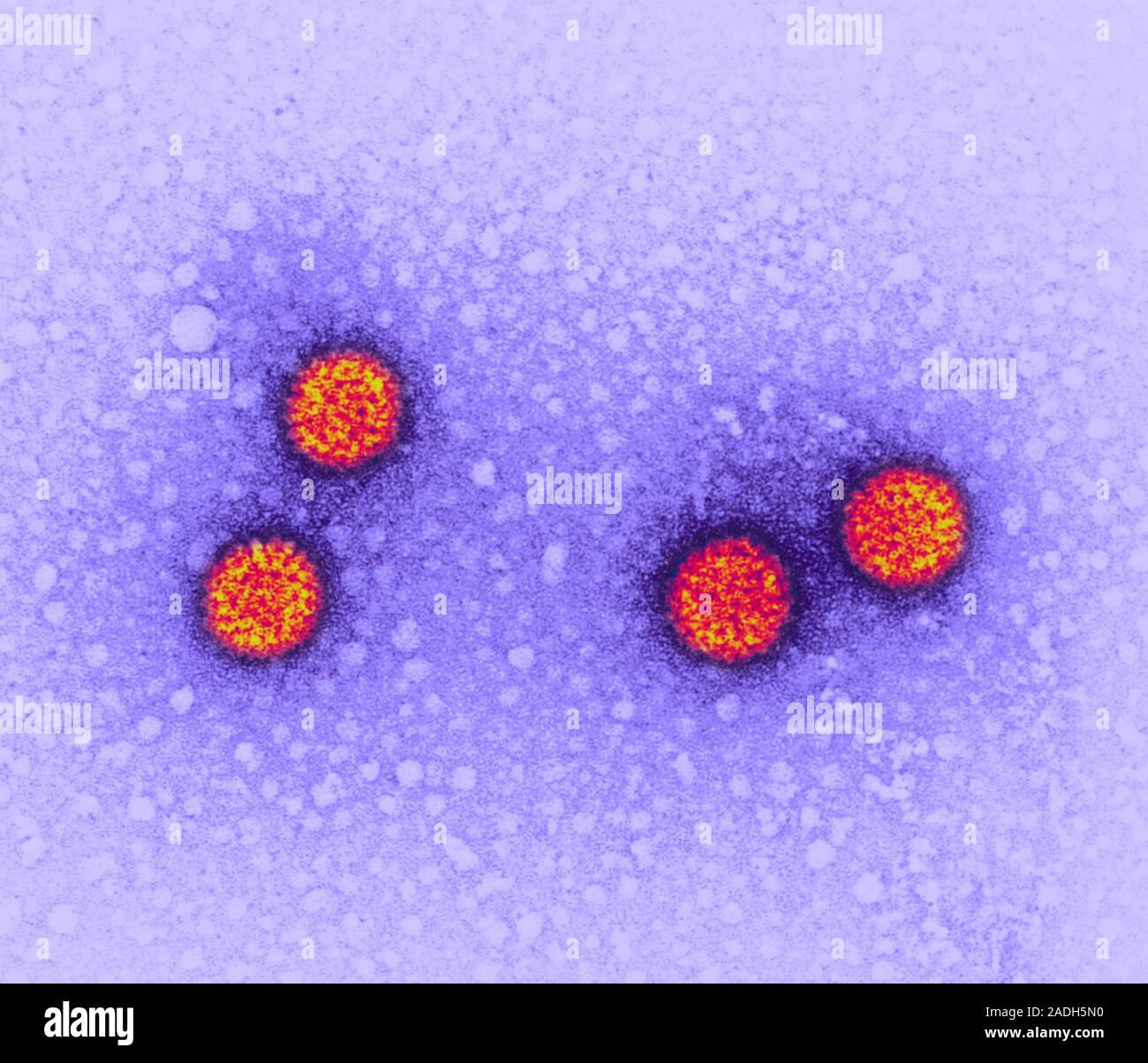 Rotavirus particles. Coloured transmission electron micrograph (TEM) of ...